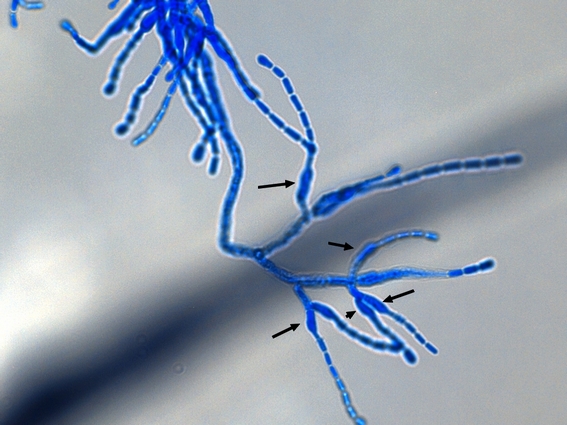 Fun With Microbiology (What's Buggin' You?): Arthrographis species