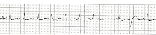ECG Rhythm Strip Quiz 112