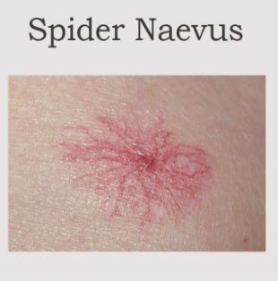 AKU HIV POSITIF: BERTEMU DR. ISKANDAR FIRZADA BIN OSMAN KALI KE-45