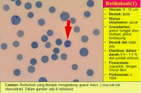 Analis Kesehatan: Menghitung Retikulosit
