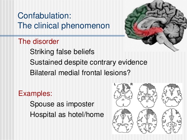 EXAMS AND ME : Confabulation
