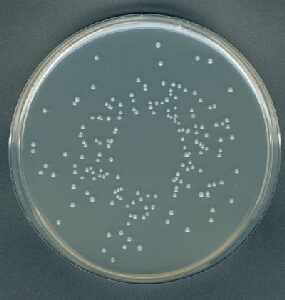 Media Plate Count Agar (PCA) ~ Medical Laboratory Technologist