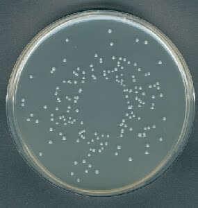 Media Plate Count Agar (PCA) ~ Medical Laboratory Technologist