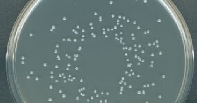 Media Plate Count Agar (PCA) ~ Medical Laboratory Technologist