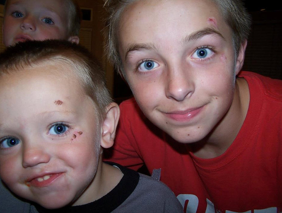 The Blackham Bunch: Scraped Up Faces