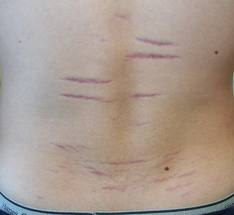 Melissa's Life - Life After 42: Resurrecting the blog for so many ...