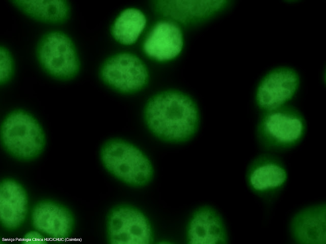 Anticorpos anti - Mi-2