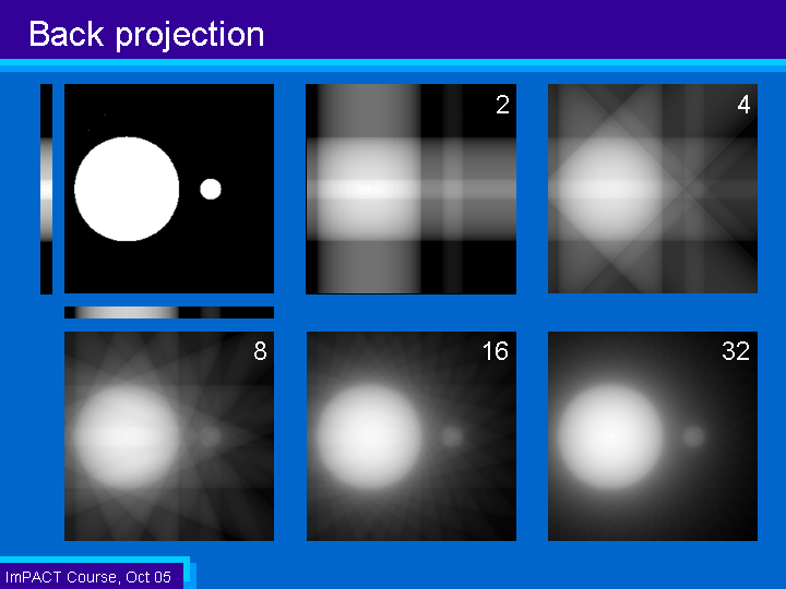 Basic principles of CT scanning ~ ct.scan.