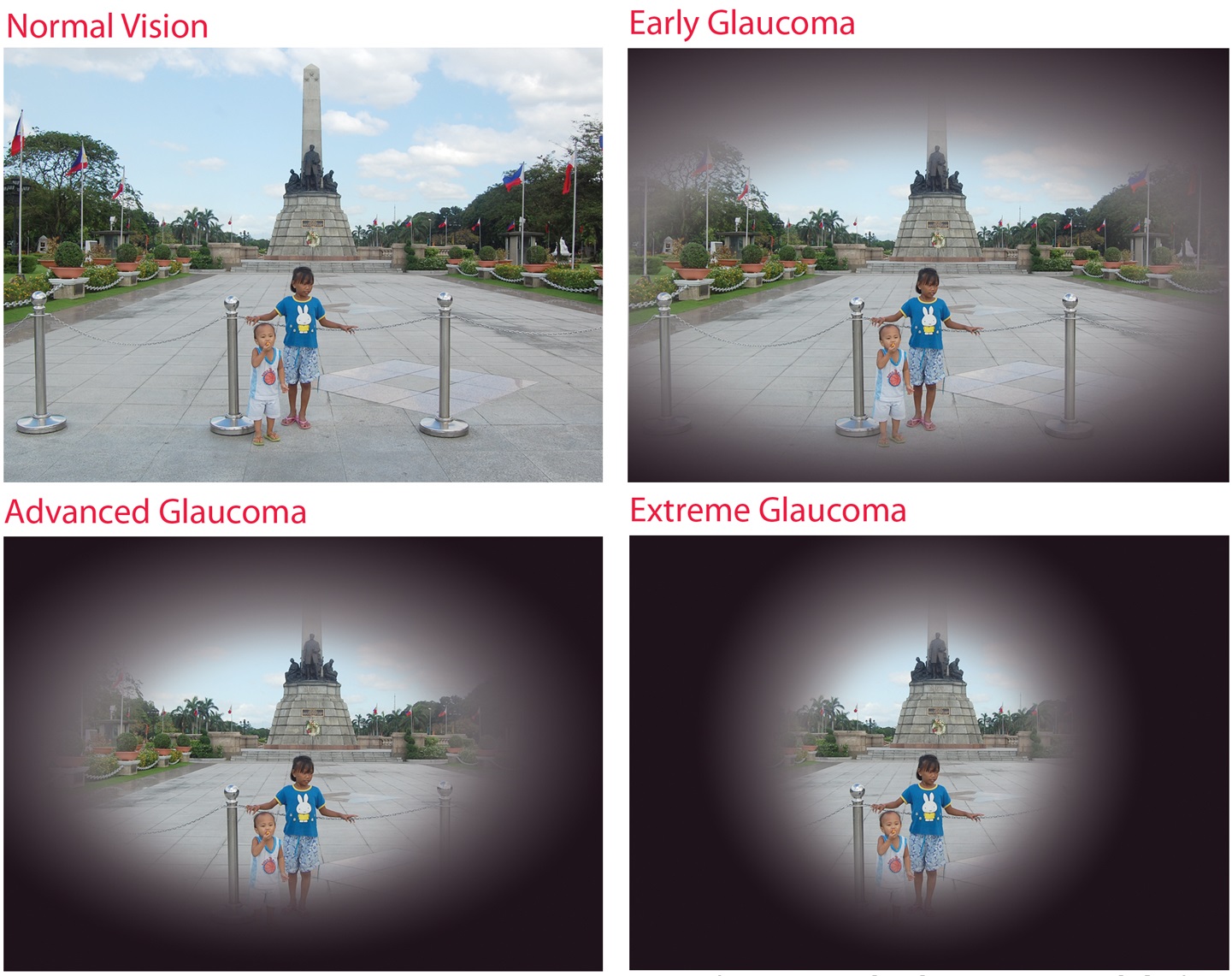 Cuidados Visuales con Cinthya Armijo de López: GLAUCOMA MUCHO CUIDADO ...