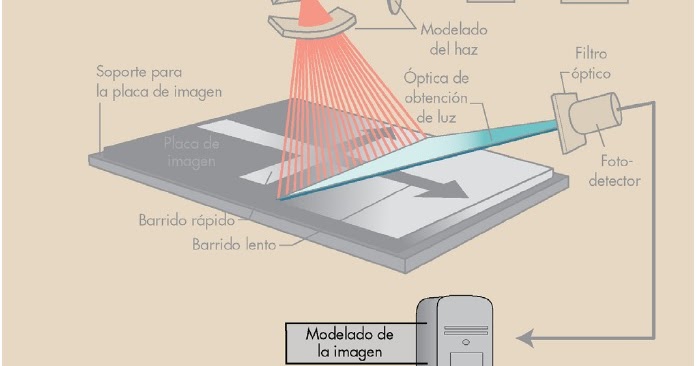 Instrumentacion: LA IMAGEN RADIOGRÁFICA DIGITAL