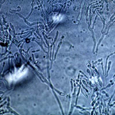 Sustainable Mycology: Paecilomyces spp.