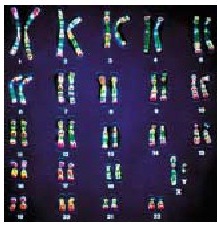 BIOLOGI SMA: Kromosom, Kromatin dan Kariotipe
