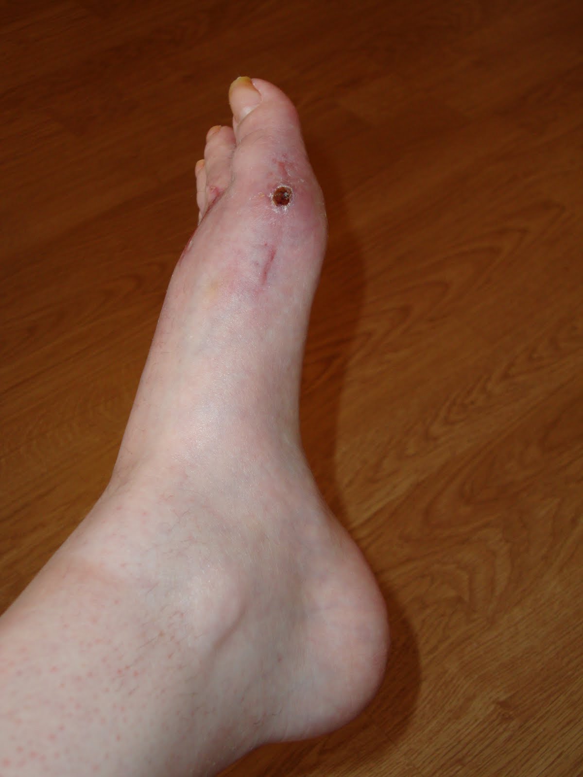 Gwen's Feet (and Hand): Week Nine Roundup