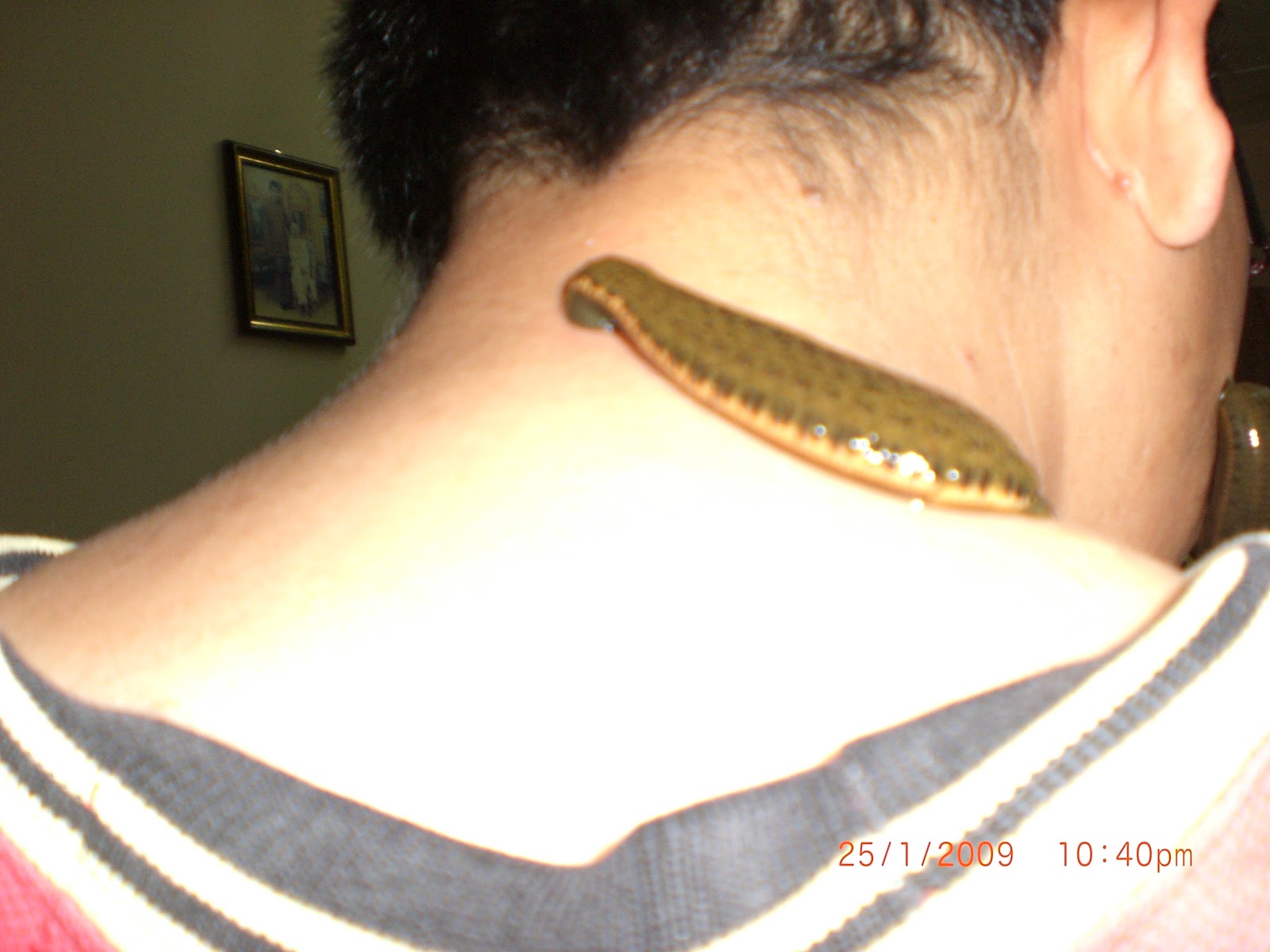 TakeCare!: LEECH THERAPY IN MALAYSIA - Painless Ancient Treatment