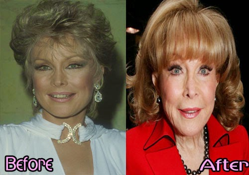 Barbara Eden Plastic Surgery Nose Job, Breast Implants, Botox ...