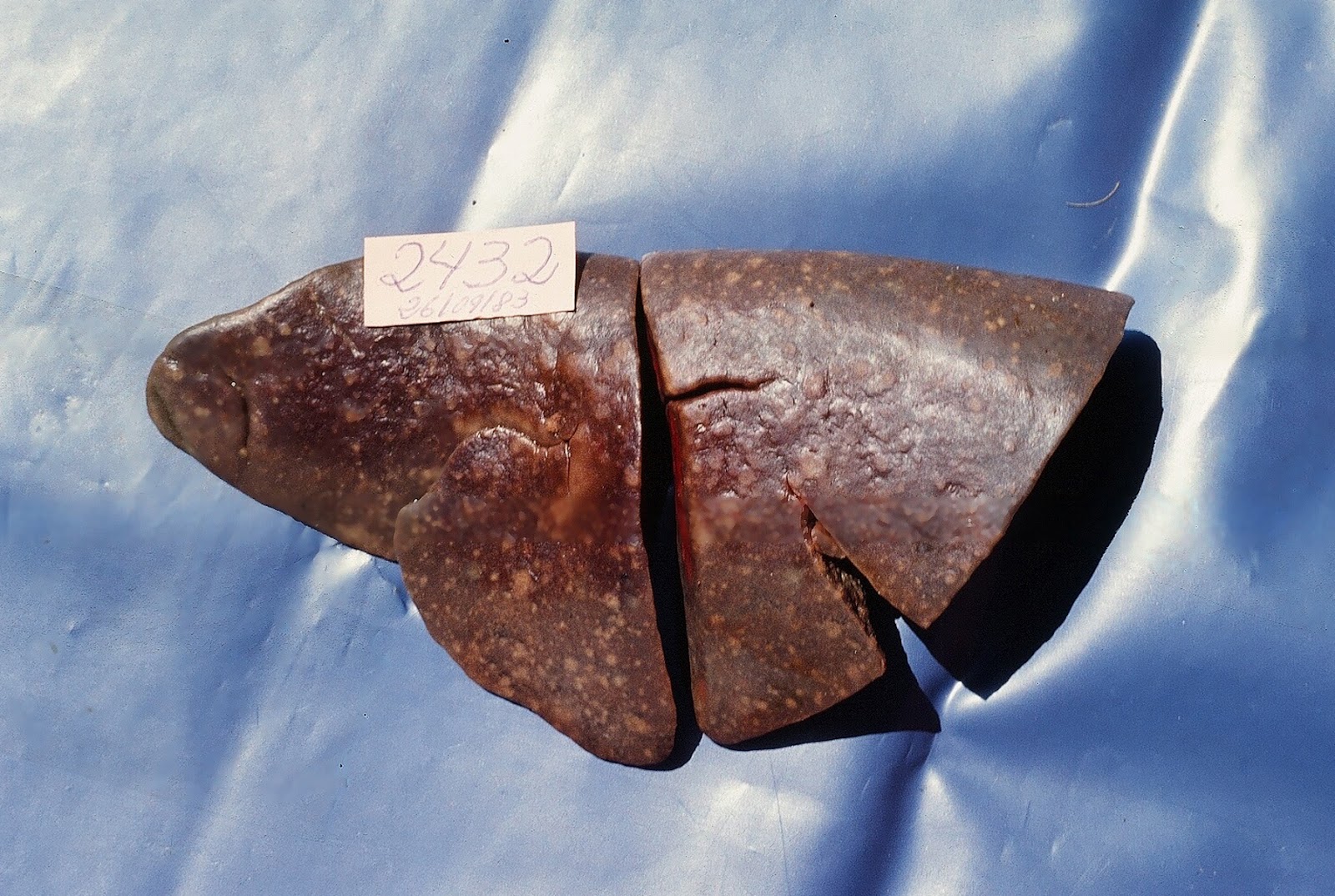 nécrose - définition - C'est quoi