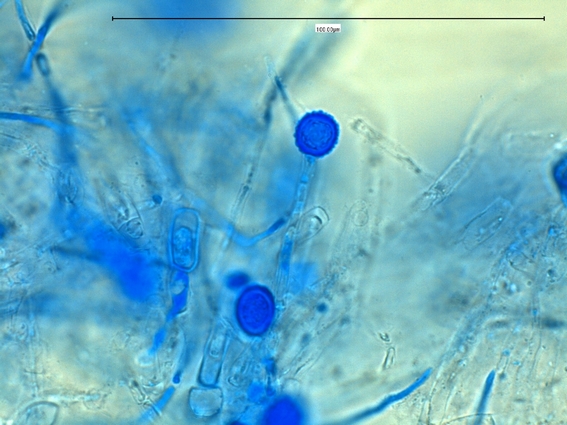 Fun With Microbiology (What's Buggin' You?): Sepedonium species