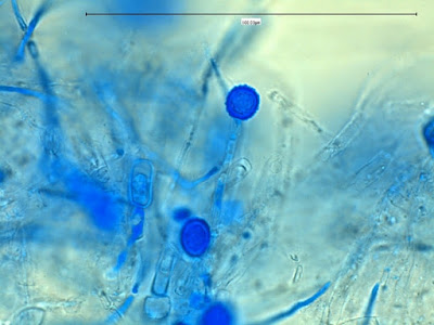 Fun With Microbiology (What's Buggin' You?): Sepedonium species