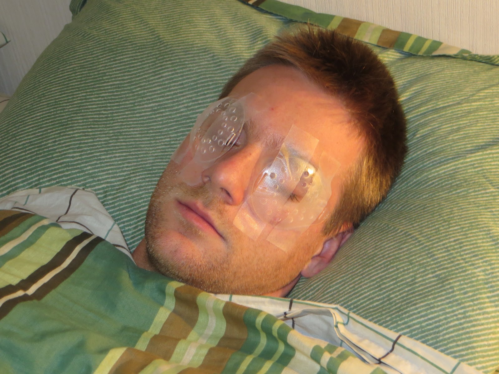 How Long To Wear Eye Shield After Lasik at Anna Octoman blog