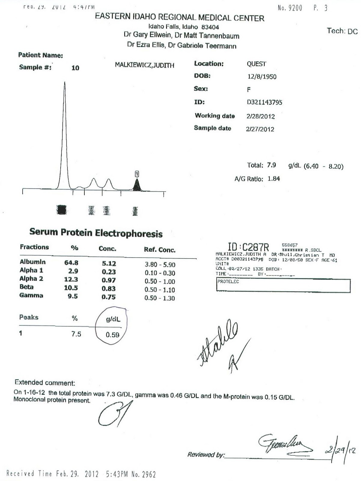 jm's Adventure with Multiple Myeloma: M-Spike on the Rise - Day 167 ...