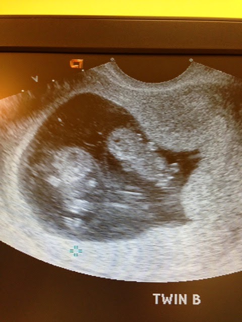 Sparkles and Lattes: Bump Update - 12 Weeks