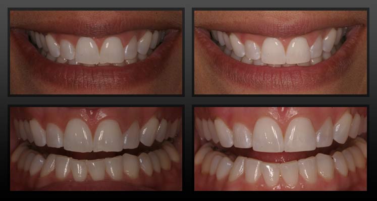 Knowledge Channel: Why do we have two sets of teeth?