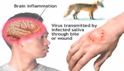 Медицински техничари и техничарке IV3: Besnilo - Lyssa