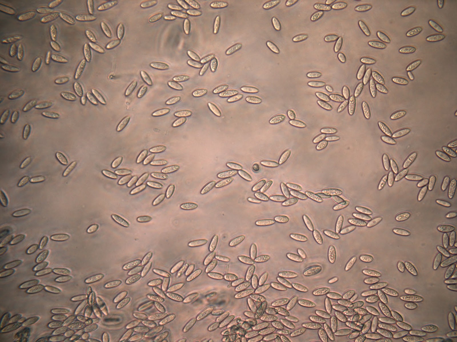 MaxwellHandiseniPLPA631: Lab 5: Conidiating Fungi