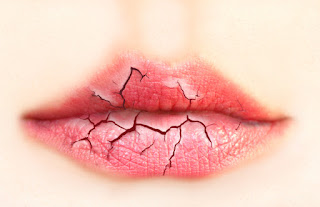 Beauty Guide: Common Lip Problems And Solutions To Them