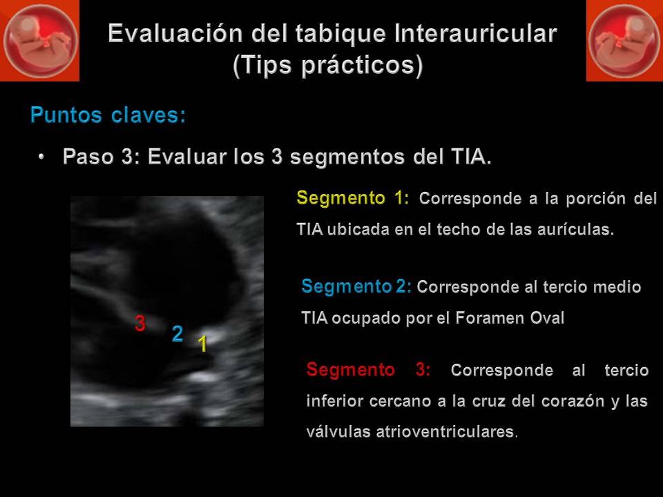 Edufetus: Tabique Interauricular un abordaje detallado por segmentos