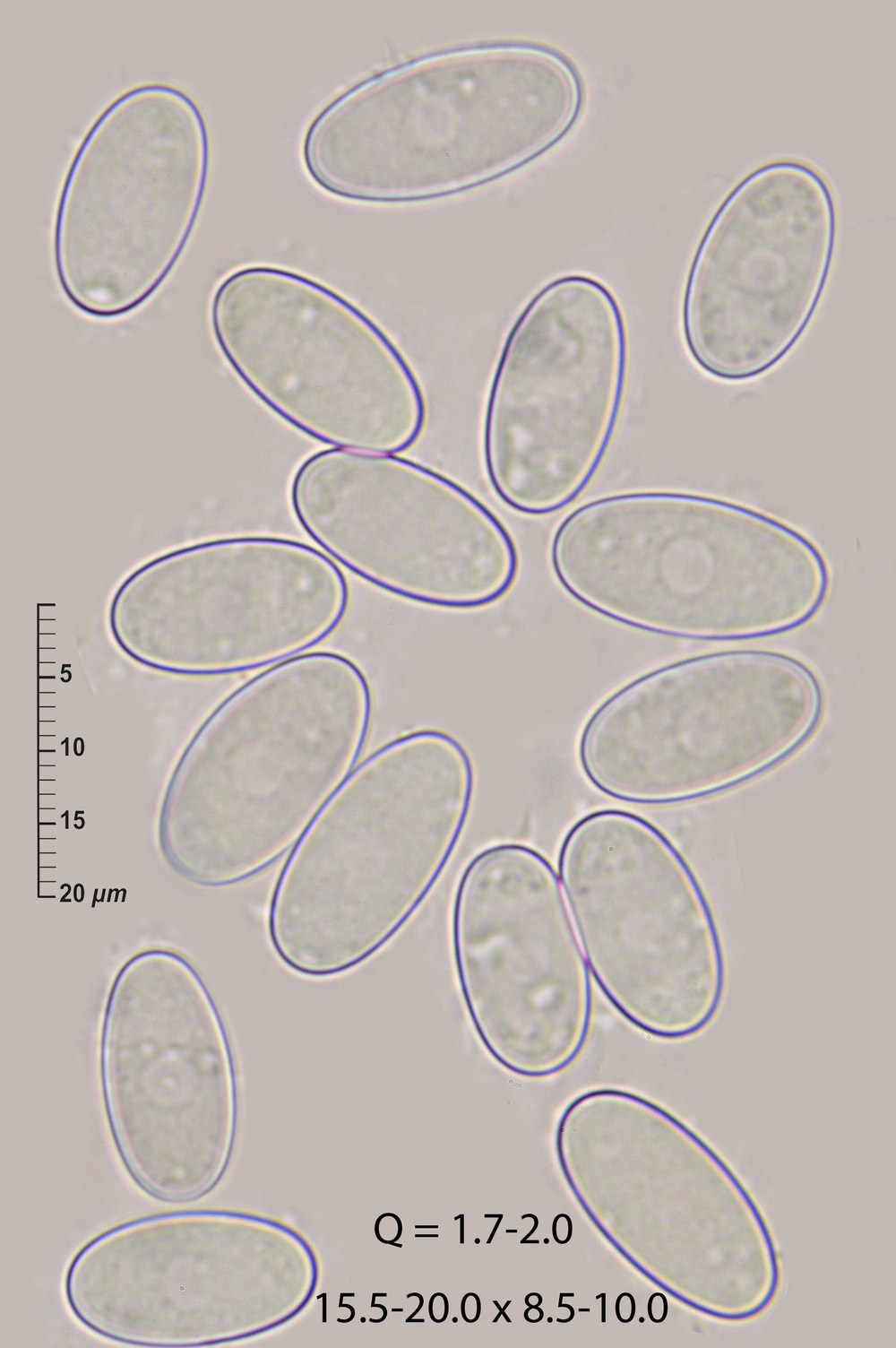 Thecotheus crustaceus (Starbäck) Aas & N. Lundq. • CEMAS Salamanca