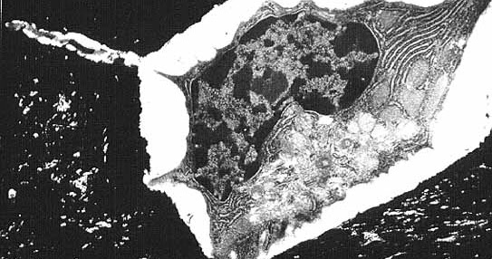 Aula virtual anatomia basica: 3.06.1.3 Osteocitos