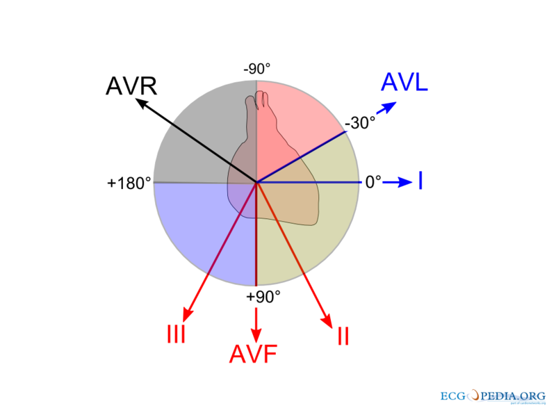 心電圖 Electrocardiogram, EKG/ECG
