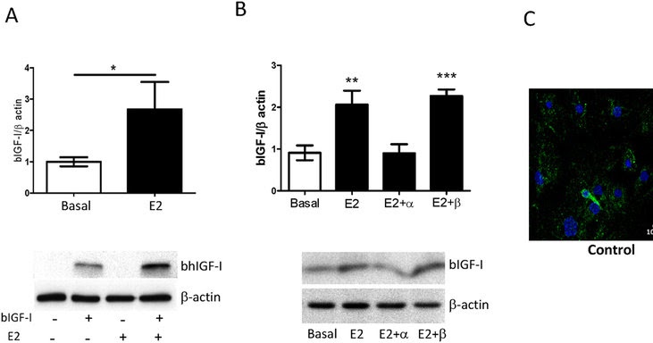Neuromics: IGF and Mood
