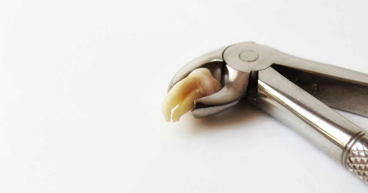 Dentosphere : World of Dentistry: Post - Extraction Instructions to ...