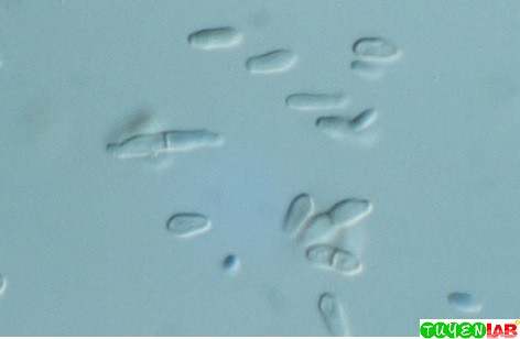 [Parasitology] Atlas of Medically Significant Fungi | Free Medical Atlas