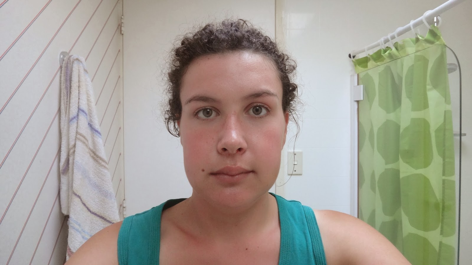 Kelsie's Jaw Surgery: Day 8: The Lopsided Face