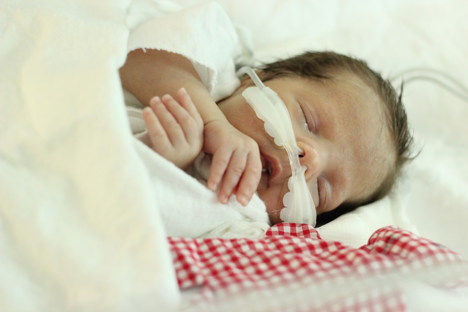 billy & lolo: :: the perks of being a highflow baby