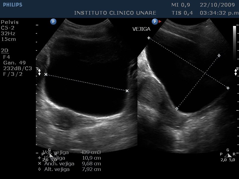 La Galeria del Eco Parte 1