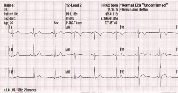 Latinski jezik za medicinske škole: EKG(elektrokardiogram)