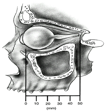 Maxillary Sinus in Health and Disease-Oral Surgery Lecture ~ Dentistry ...
