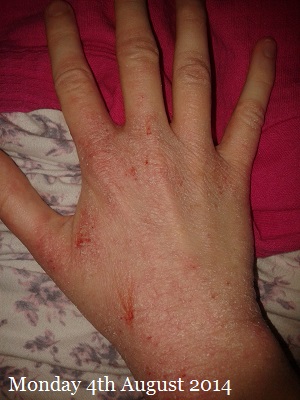 Hand-some | TSW Cara