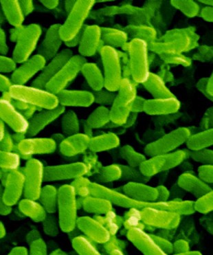Bakteri Escherichia Coli