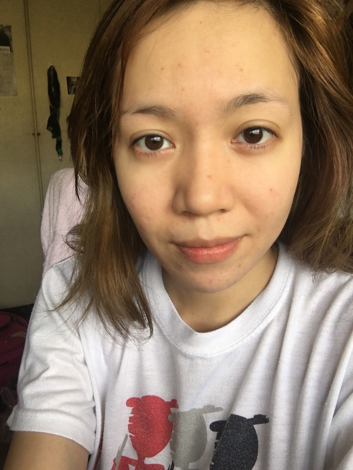 Pink Paradox: REVLITE FROM SKIN 101 REVIEW