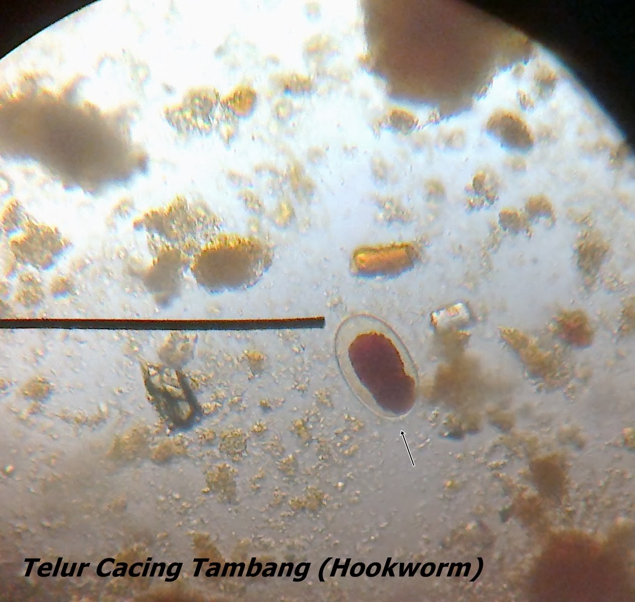 Rizqi Murtafi'ah: Pemeriksaan Telur Cacing Dengan Metode Teknik NaCl Jenuh