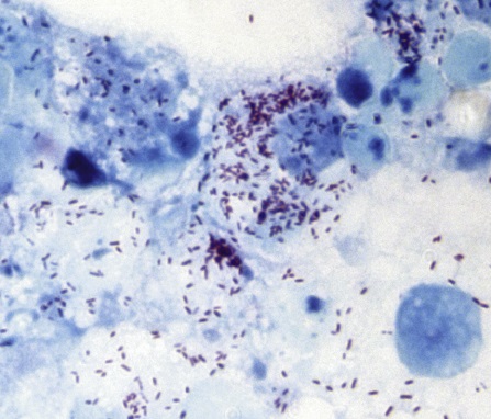 Lecture Notes in Medical Technology: Lecture #15: RICKETTSIA, CHLAMYDIA ...