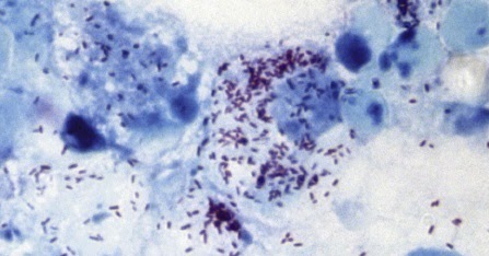 Lecture Notes in Medical Technology: Lecture #15: RICKETTSIA, CHLAMYDIA ...