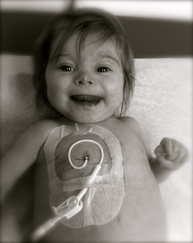 my cancer story: 01.09.96 - Getting an Upgrade