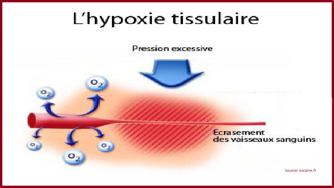 Hypoxie Cellulaire; Cellule, hypoxie