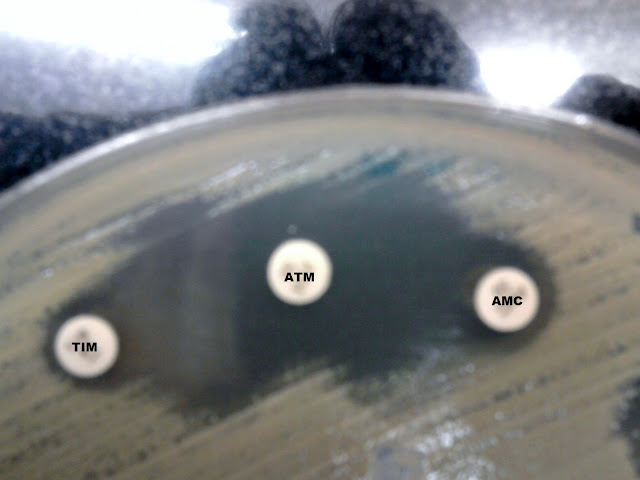 MedTek101: ESBL producers